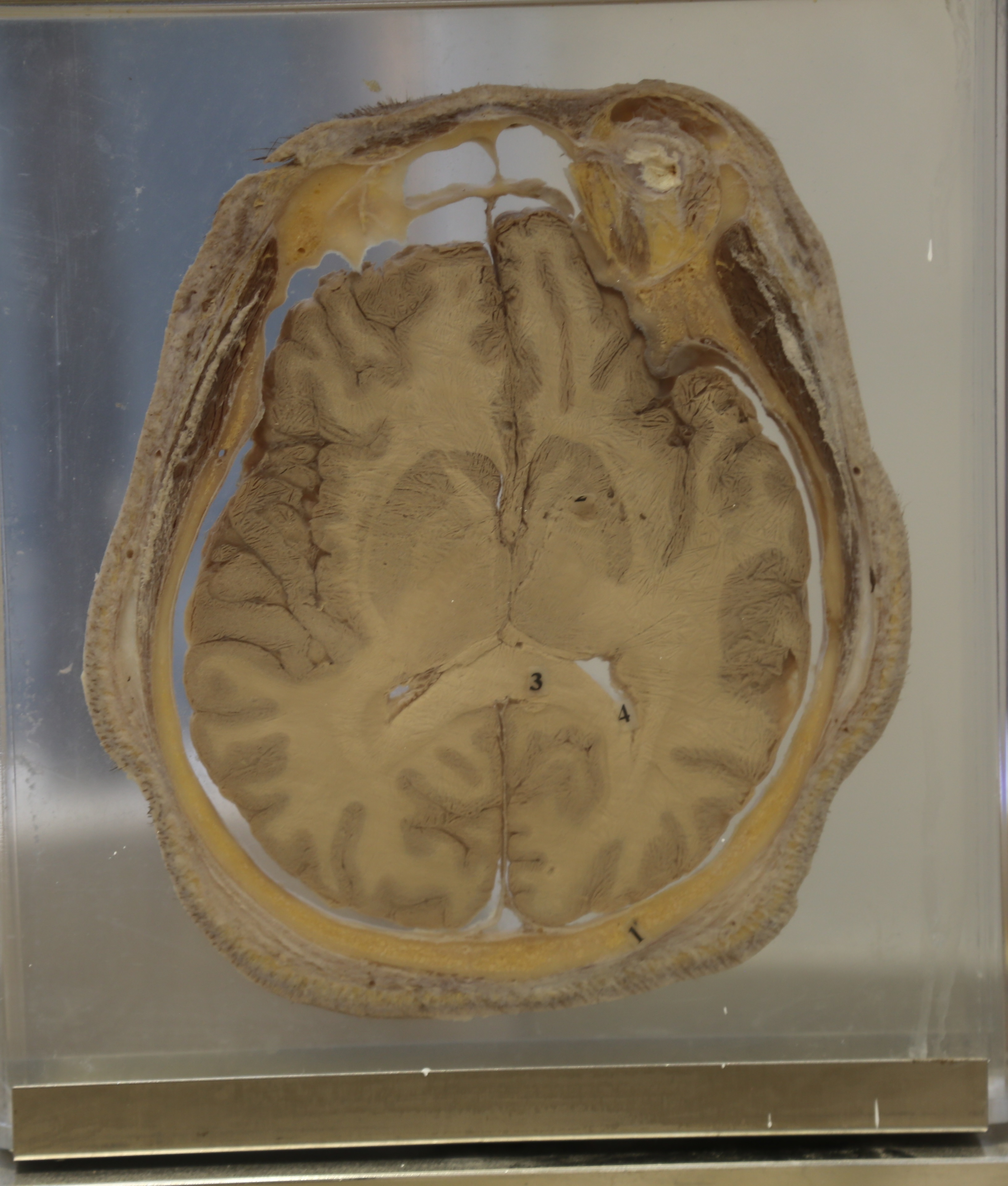 CS-06-006人体水平面006-河南大学基础医学院